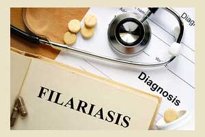Two common gout medicines may benefit patients of filariasis, finds new ...